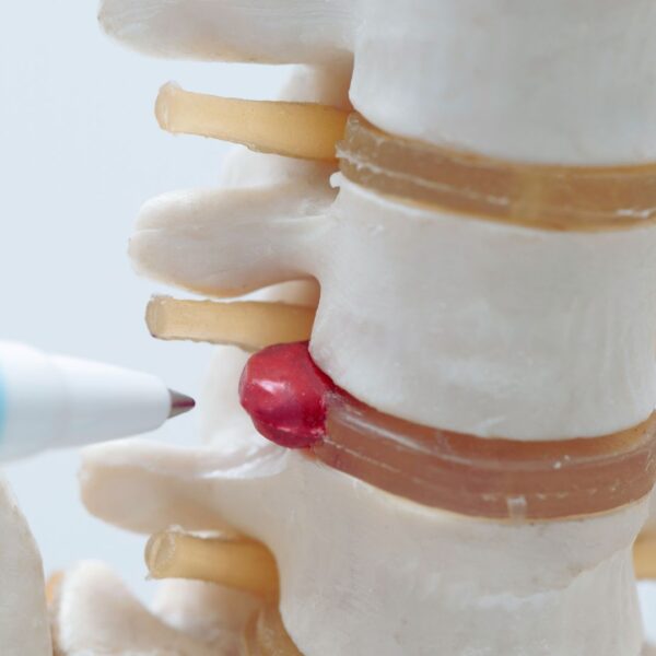 Common Minimally Invasive Back Surgeries - Call Today